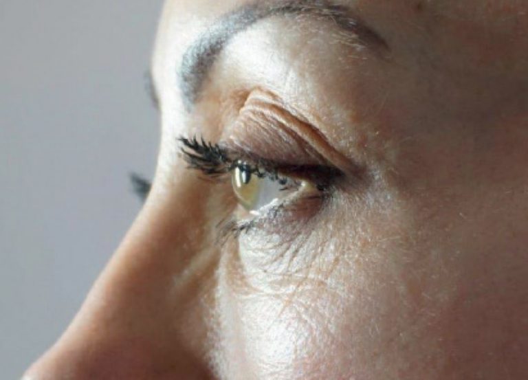 CACI Non Surgical Facelift Treatment Bronte Eastern Suburbs Bondi ...